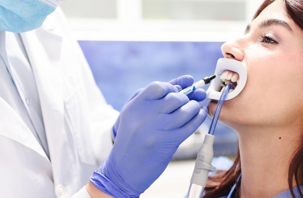 Good Teeth Whitening: Tips from Your Local Memorial Dentist